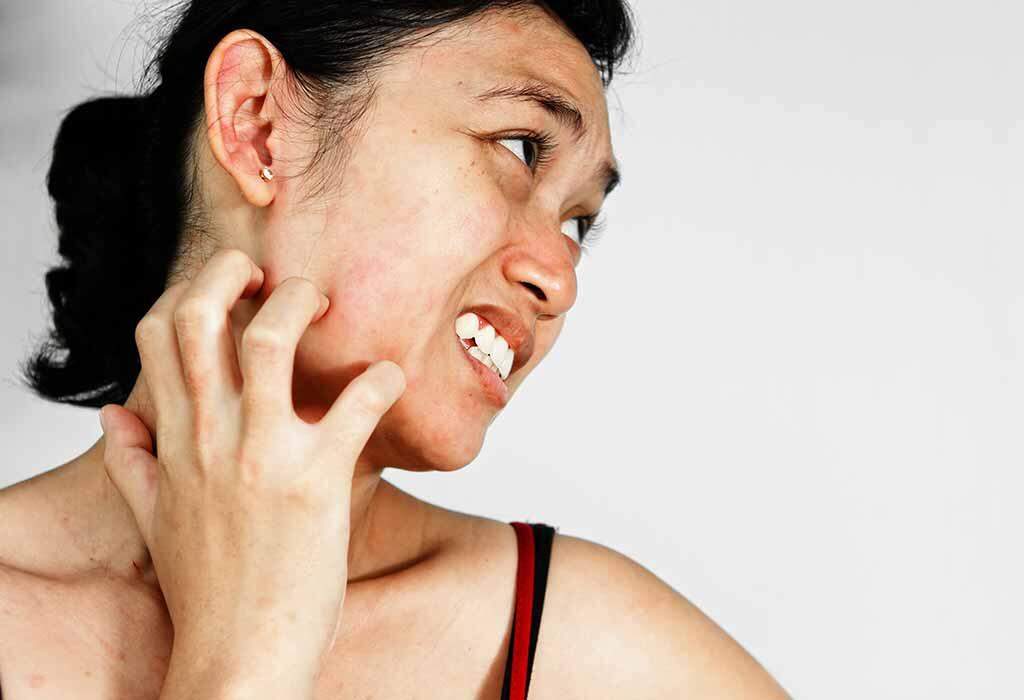 This is how you can get rid of rashes at home